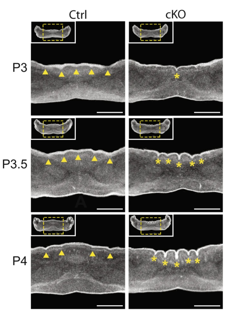 Collaborative team investigates protein that underlies CHARGE syndrome ...