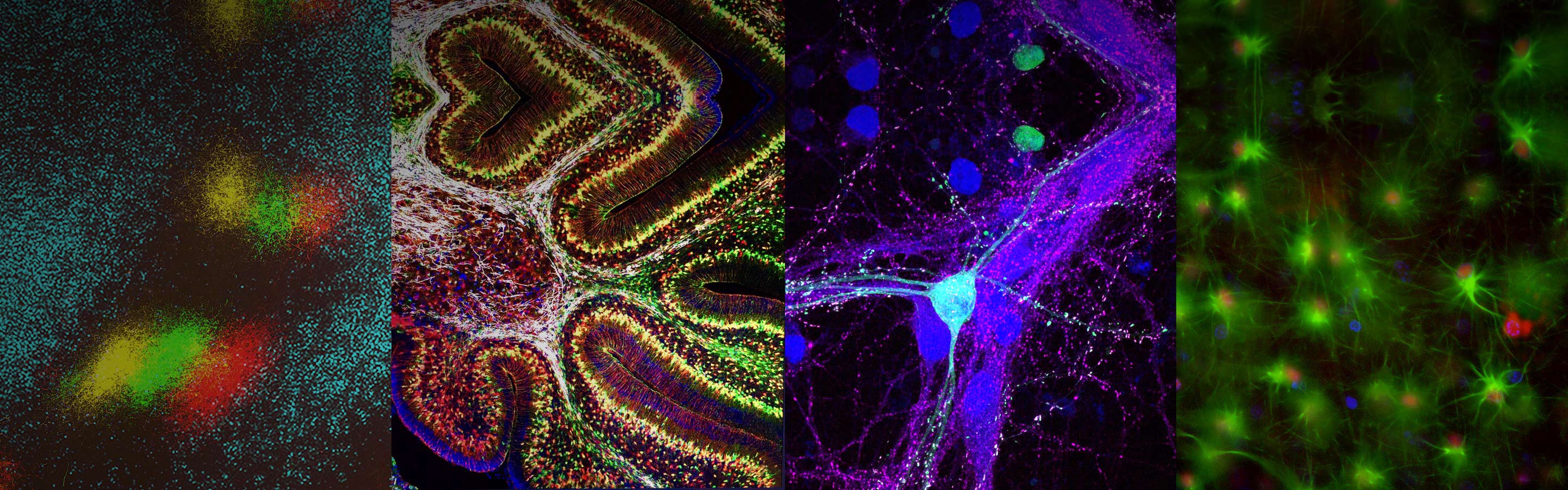 Department of Neuroscience - Washington University School of Medicine